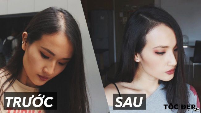 Hướng dẫn lựa chọn Dầu gội kích thích mọc tóc nhanh và hiệu quả - Mytour