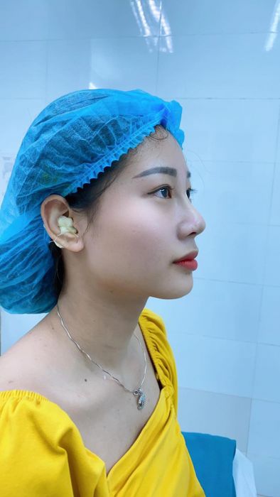 Top 7 Địa chỉ nâng mũi đẹp và an toàn ở Phường Nam Nha Trang, Khánh Hòa